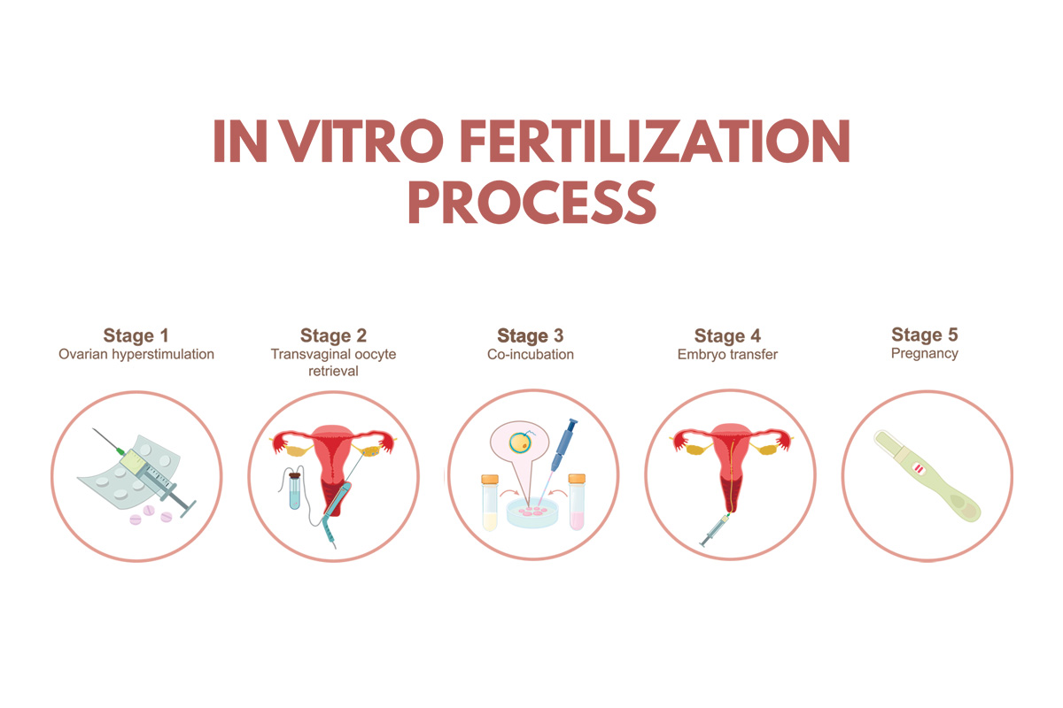 Understanding IVF and Why it Is so Common